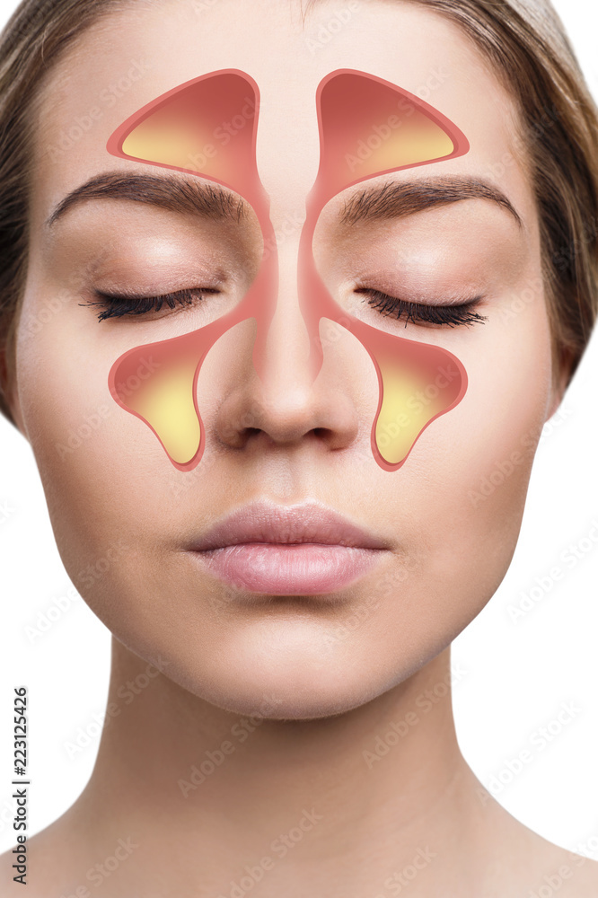 Female face shows nasal sinus with cold over white background. Stock ...