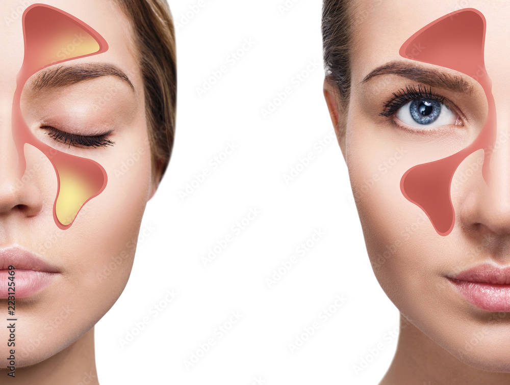 Female face shows nasal sinus with cold over white background. Stock ...