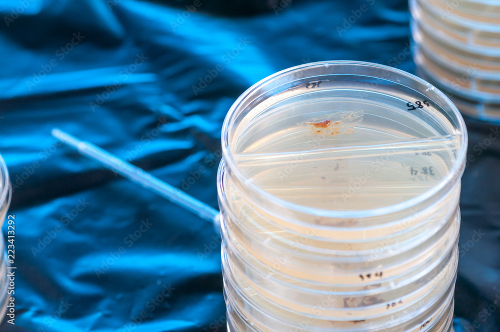 Stool sample on petri dish. Laboratory doctor holding Salmonella ...