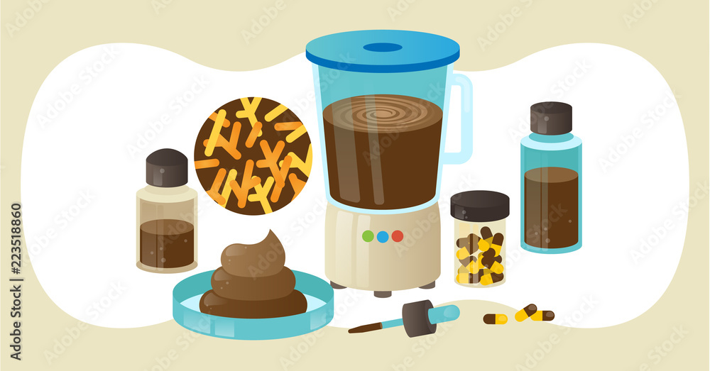 Fecal microbiota transplant (FMT) or stool transplant procedure equipment, vector illustration ...
