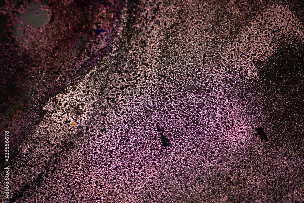 Foto de Study of white blood cells are the cells of the immune system ...