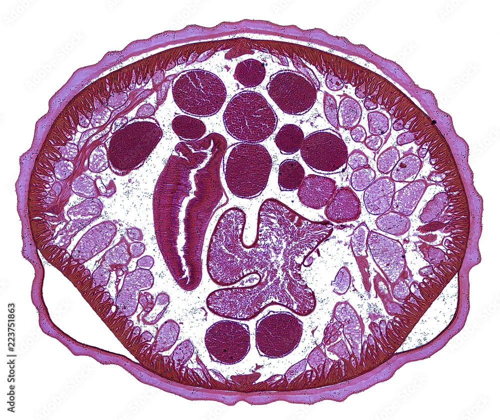 ascaris - cross section cut under the microscope – microscopic view of ...