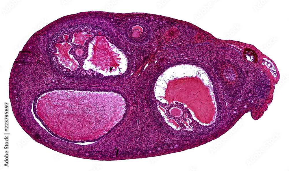 stratified squamous epithelium - cross section cut under the microscope ...