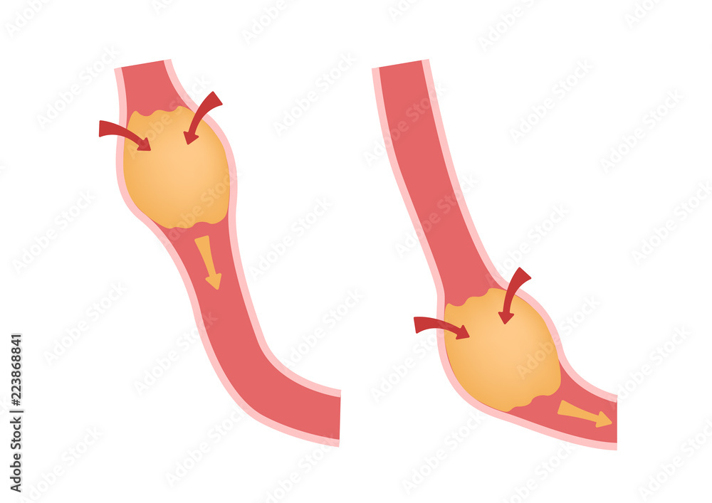 Digestion and Peristalsis vector / intestine Stock Vector | Adobe Stock