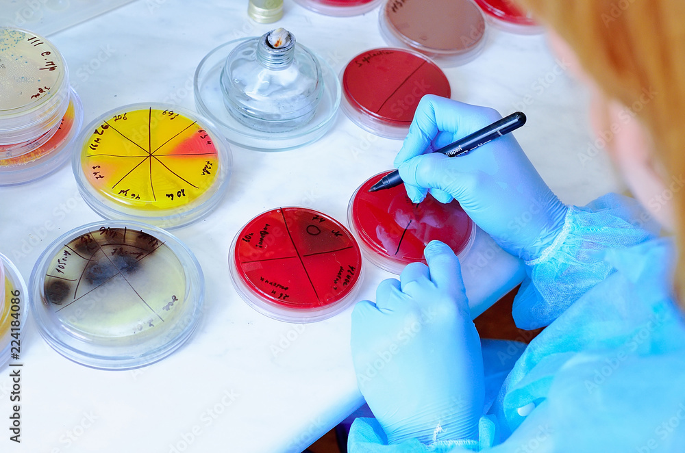 Petri dish. Microbiological laboratory. Mold and fungal cultures ...