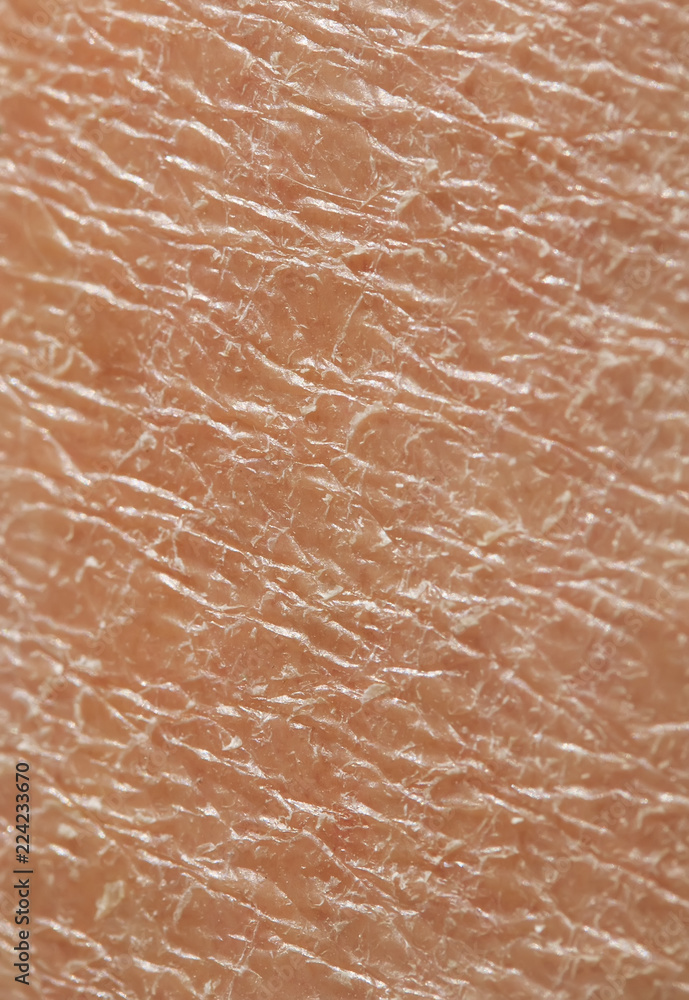 human skin texture covered with fine wrinkles and dry flaky particles ...
