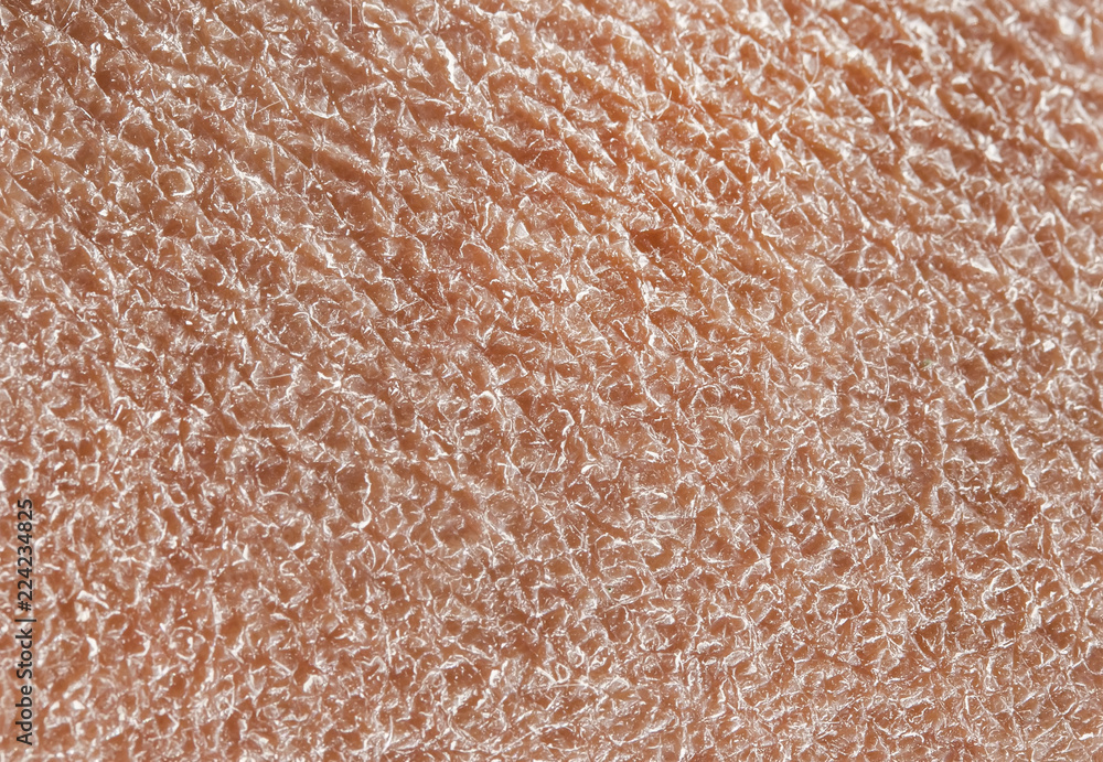 background texture of unhealthy human skin covered with deep wrinkles ...
