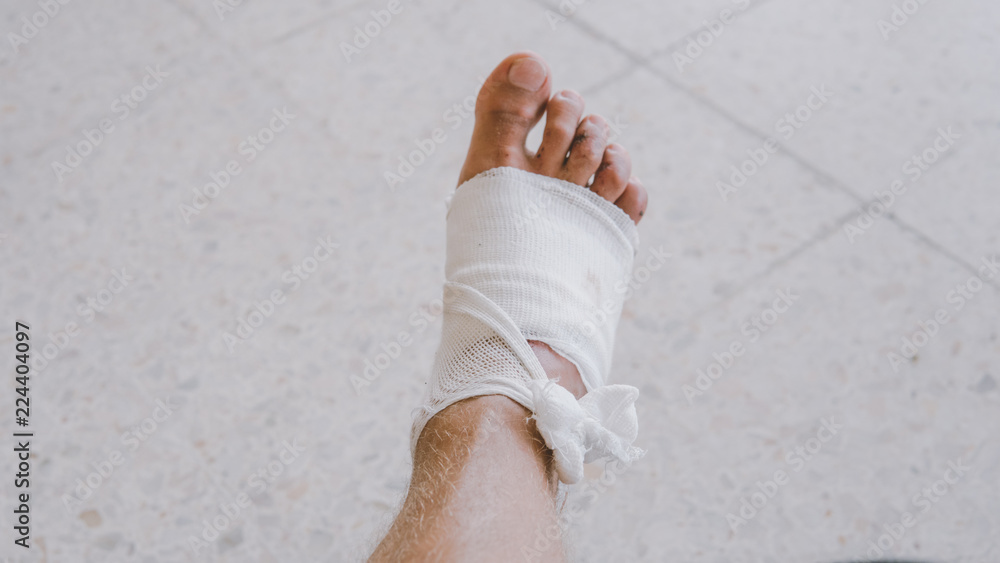 Bandaged leg after abrasion. Protect scratched body parts in travel ...