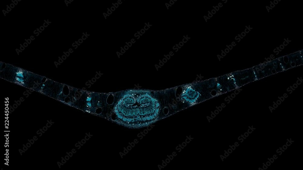 eucalyptus leaf - cross section cut under the microscope – microscopic ...