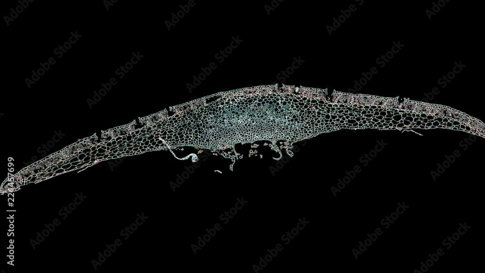 liverwort leaf - cross section cut under the microscope – microscopic ...