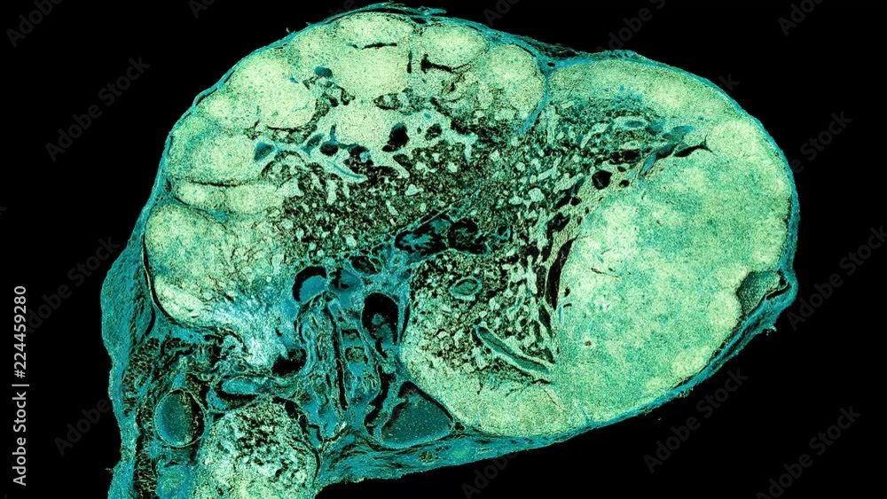 lymphonodus - cross section cut under the microscope – microscopic view ...