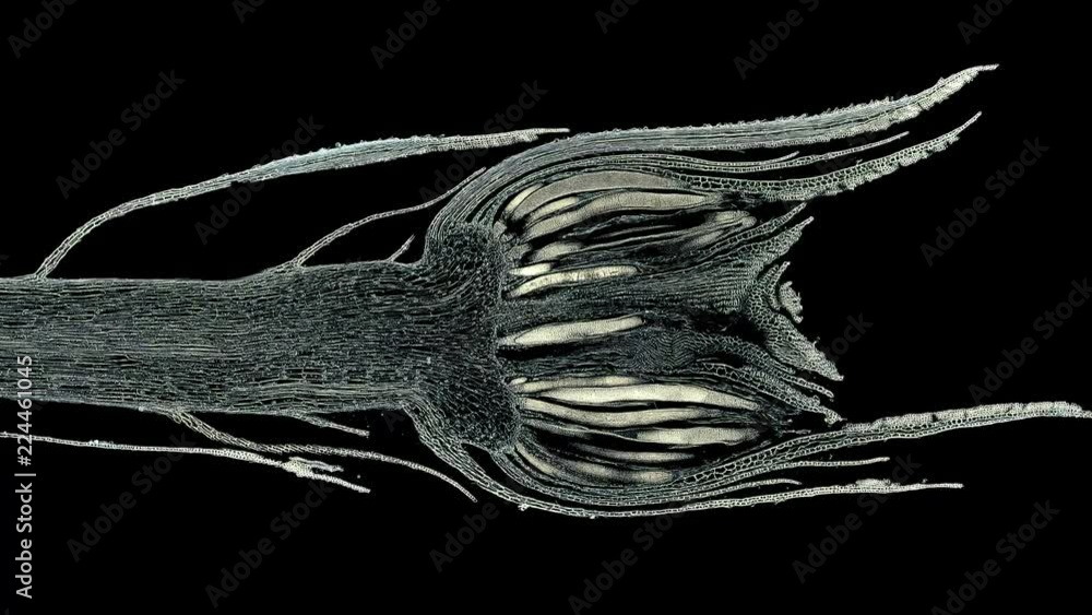 moss antheridium - cross section cut under the microscope – microscopic ...