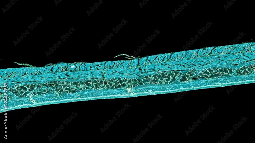 stratified squamous epithelium - cross section cut under the microscope ...