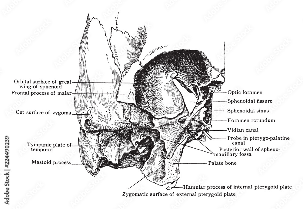 Skull Showing Posterior Wall of Sphenomaxillary Fossa, vintage ...