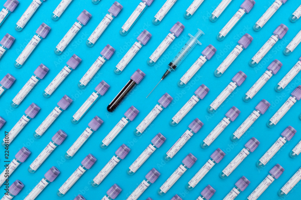 Hematology blood analysis report with lavender color sample collection ...