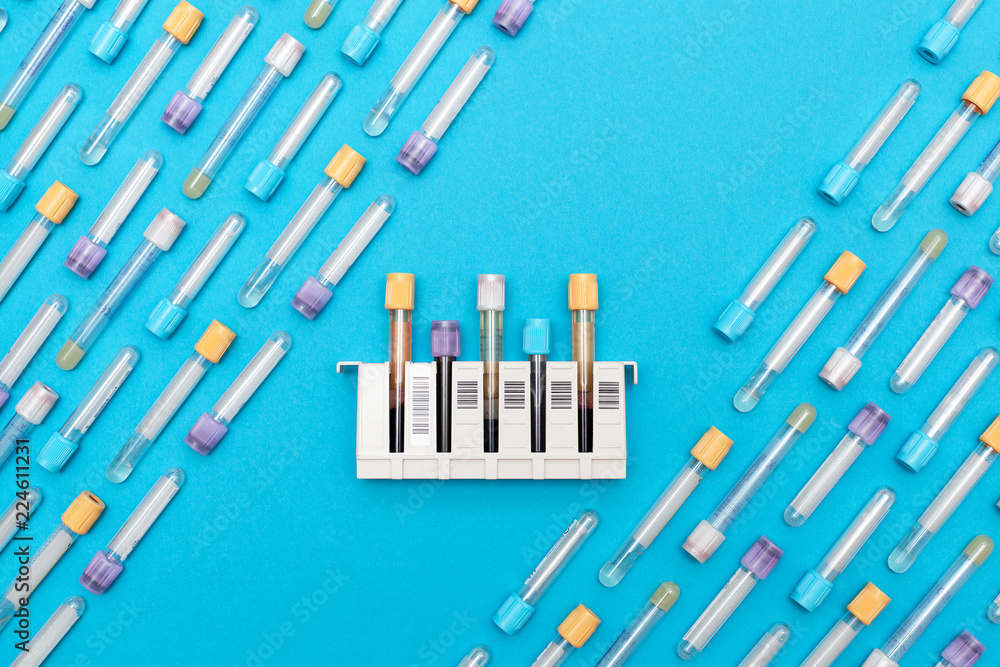 Blood samples in a rack. medicine test tubes blood for blue background ...