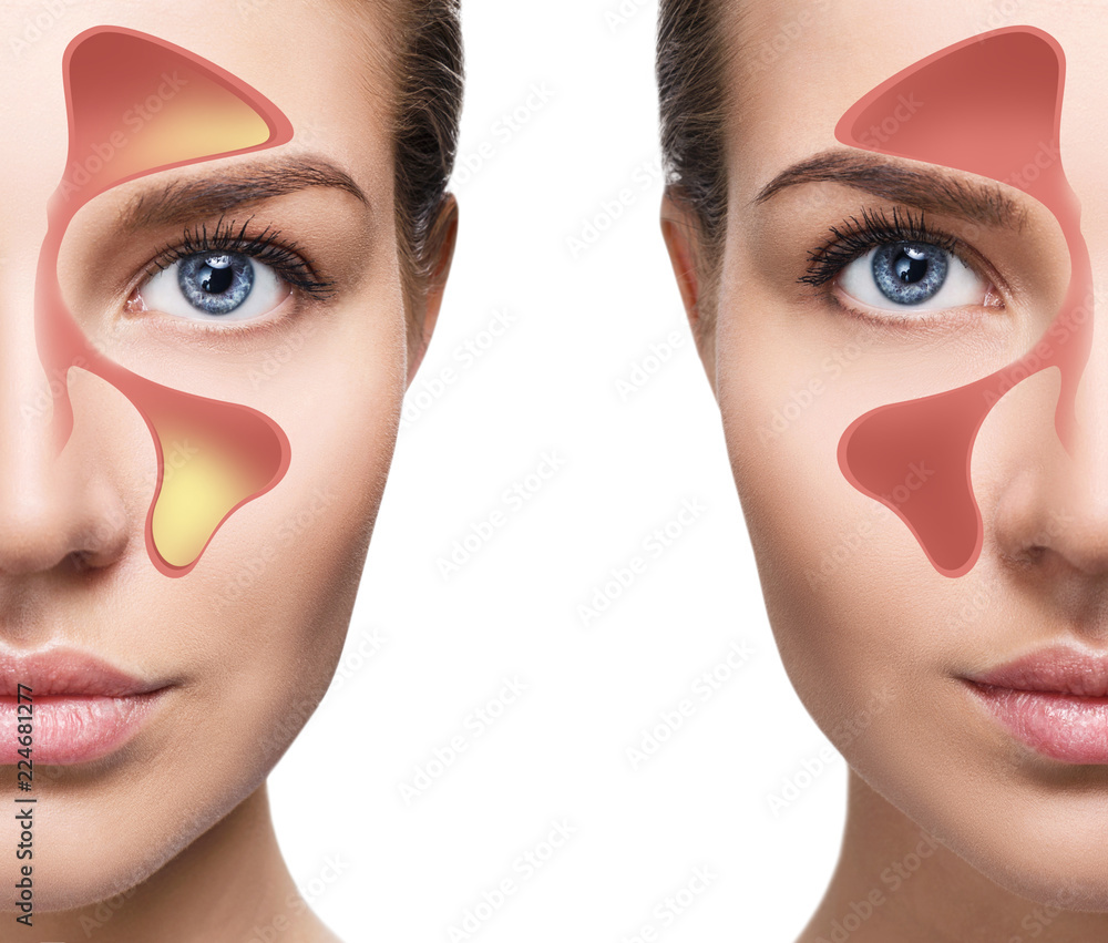 Female face shows nasal sinus with cold over white background. Stock ...
