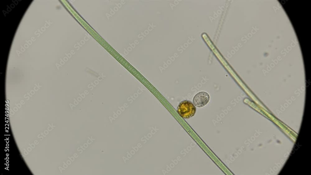 Infusoria Urotricha farcta, which serves as an indicator of water ...