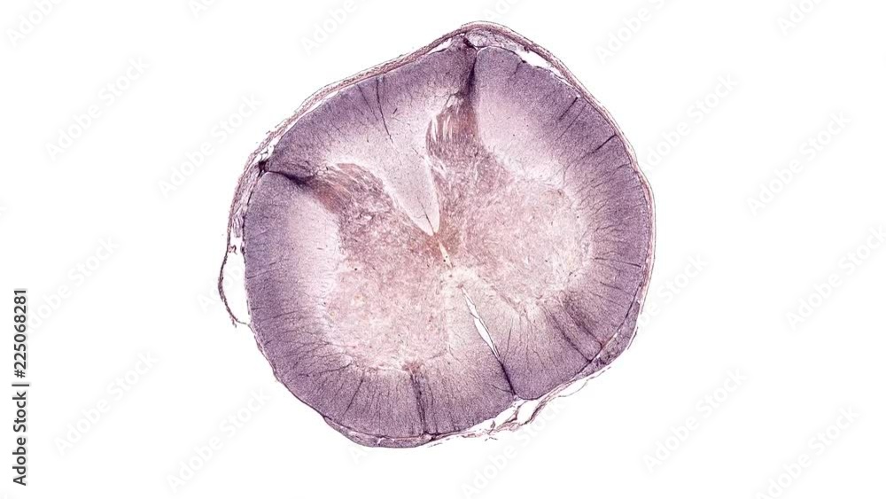 spinal cord human - cross section cut under the microscope ...