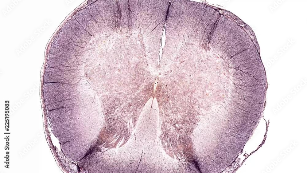 spinal cord human - cross section cut under the microscope ...