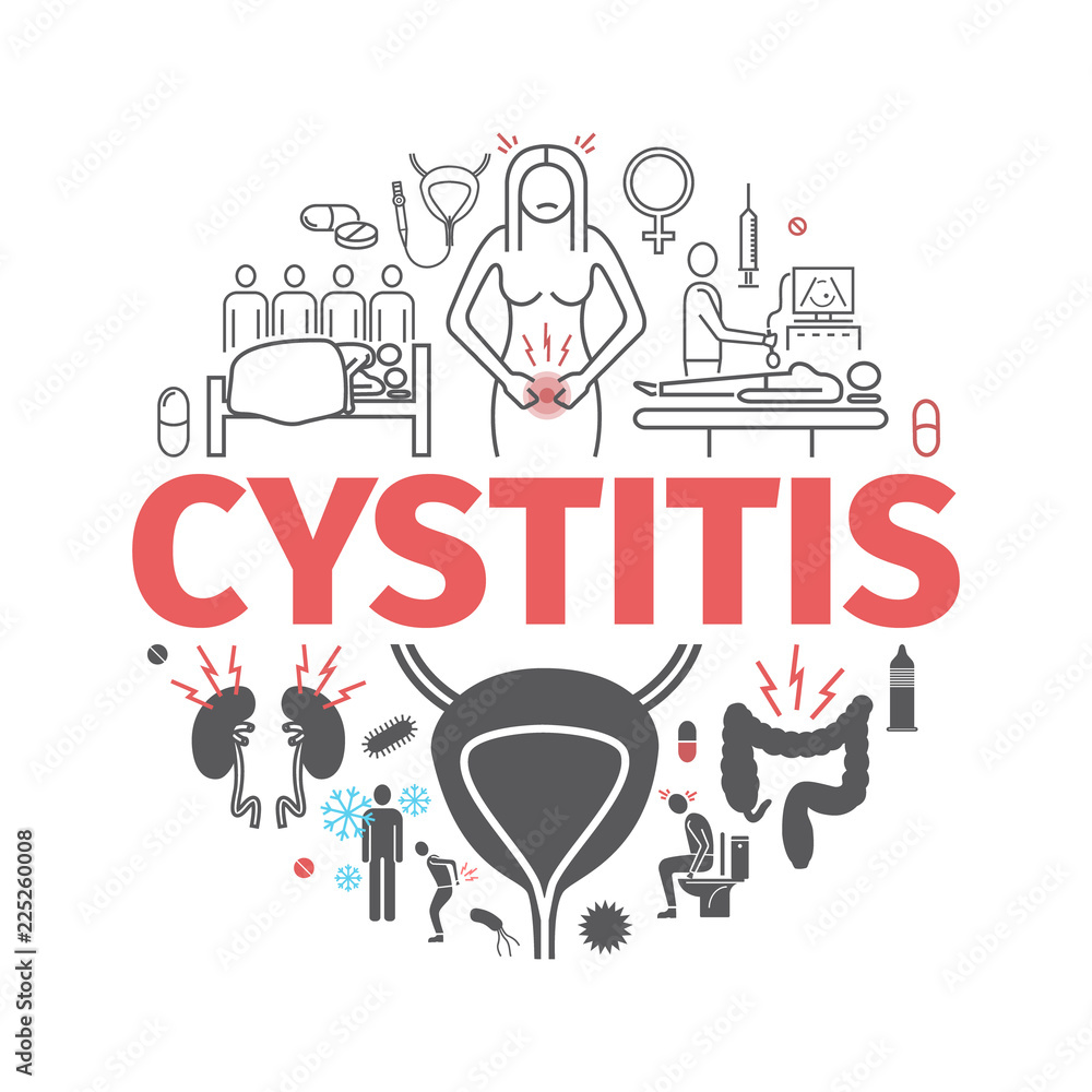 Cystitis banner. Symptoms, Treatment. Vector signs for web graphics ...