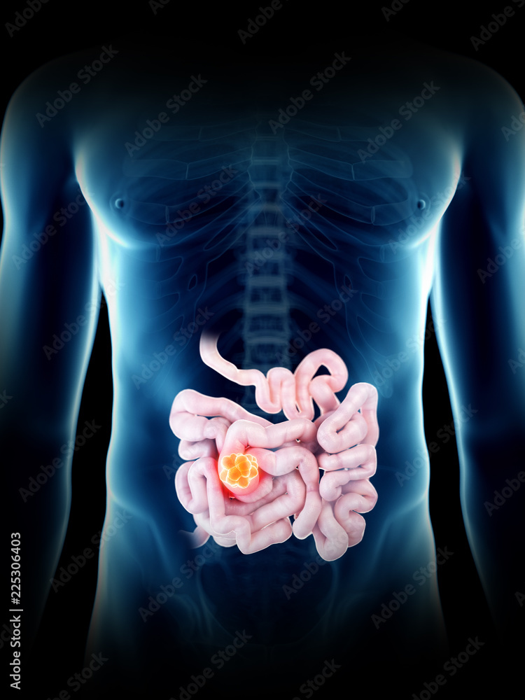 3d rendered medically accurate illustration of a mans small intestine ...