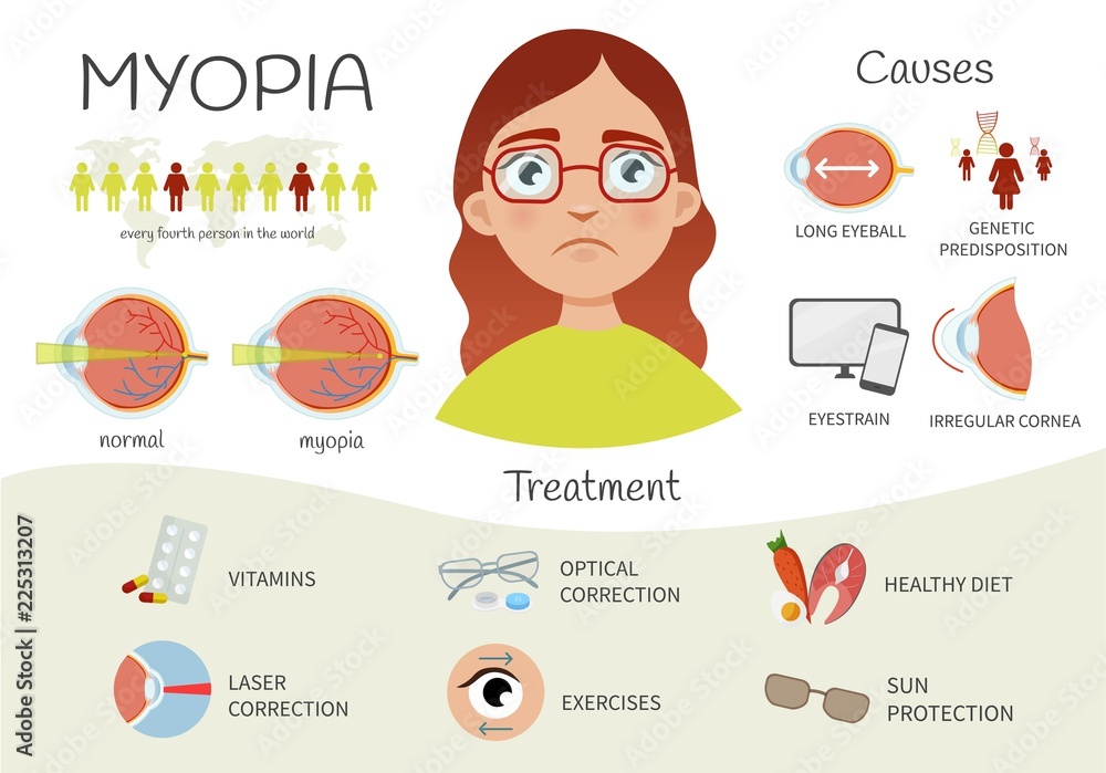 Infographics of myopia. Defects of vision. Illustration of a cute girl ...