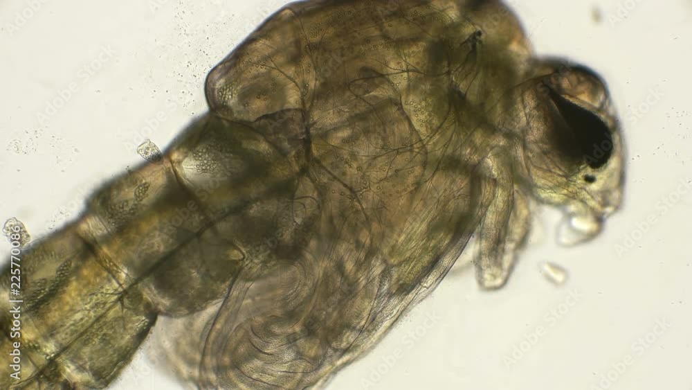 last stage of the mosquito larva - pupa, under the microscope Stock ...