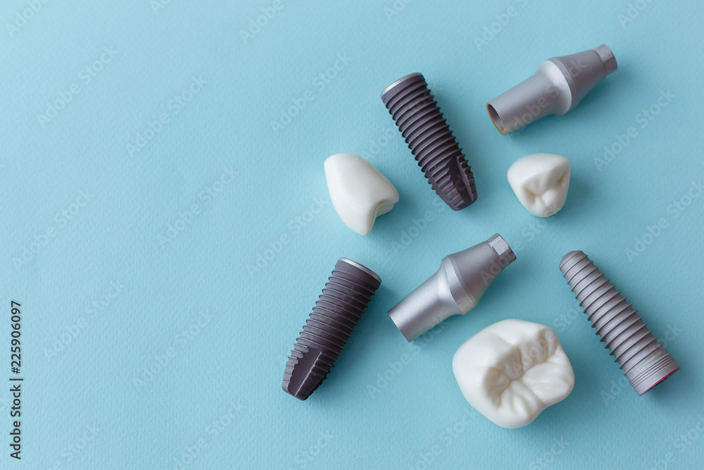 This model shows that teeth have been capped and the stainless pin in ...