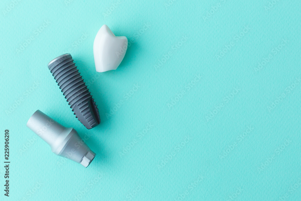 This model shows that teeth have been capped and the stainless pin in ...