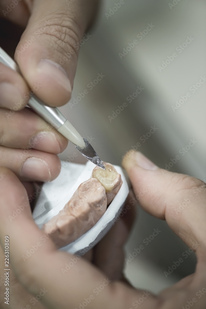 Artificial teeth Stock Photo | Adobe Stock