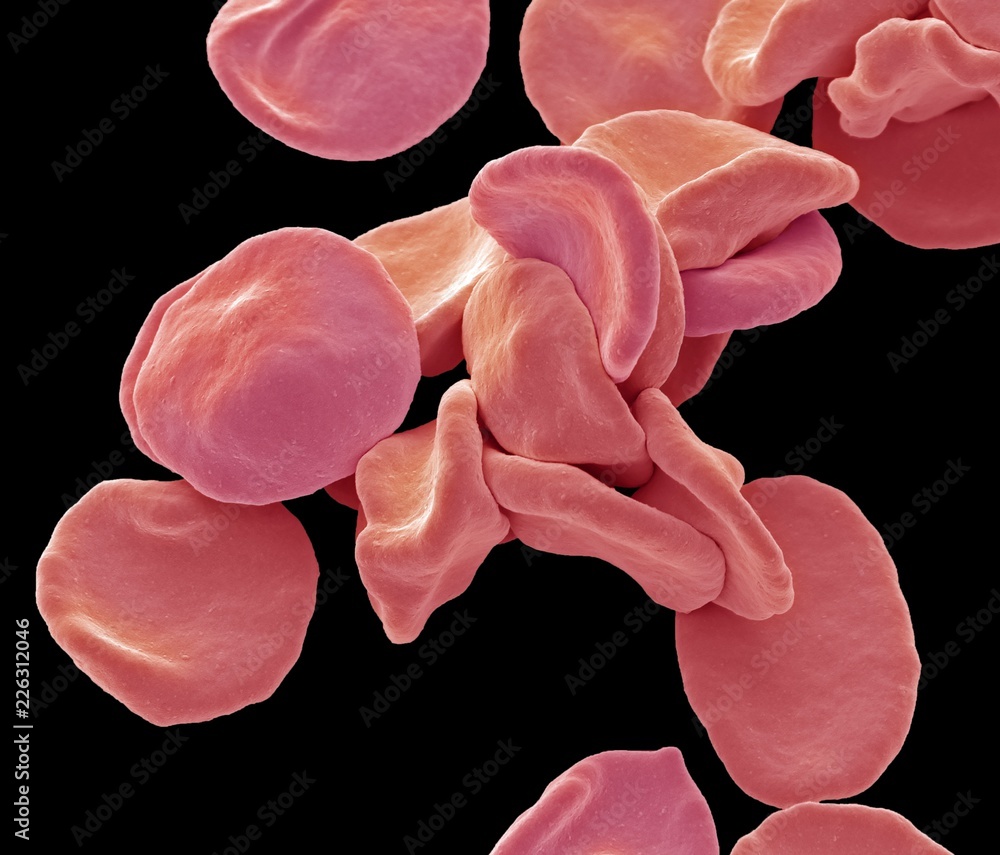 Red blood cells, SEM Stock Photo | Adobe Stock