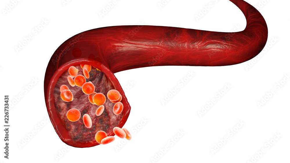 Globuli rossi e flusso di sangue attraverso una vena, piccole cellule ...