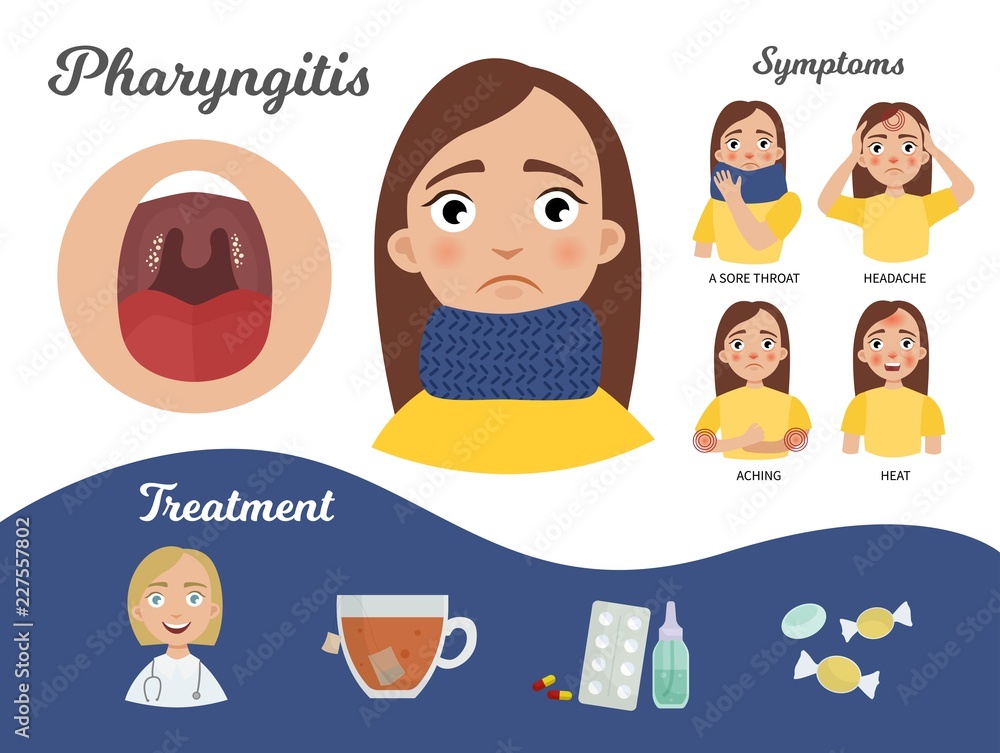 Infographics of pharyngitis. Illustration of a cute girl. Statistics ...