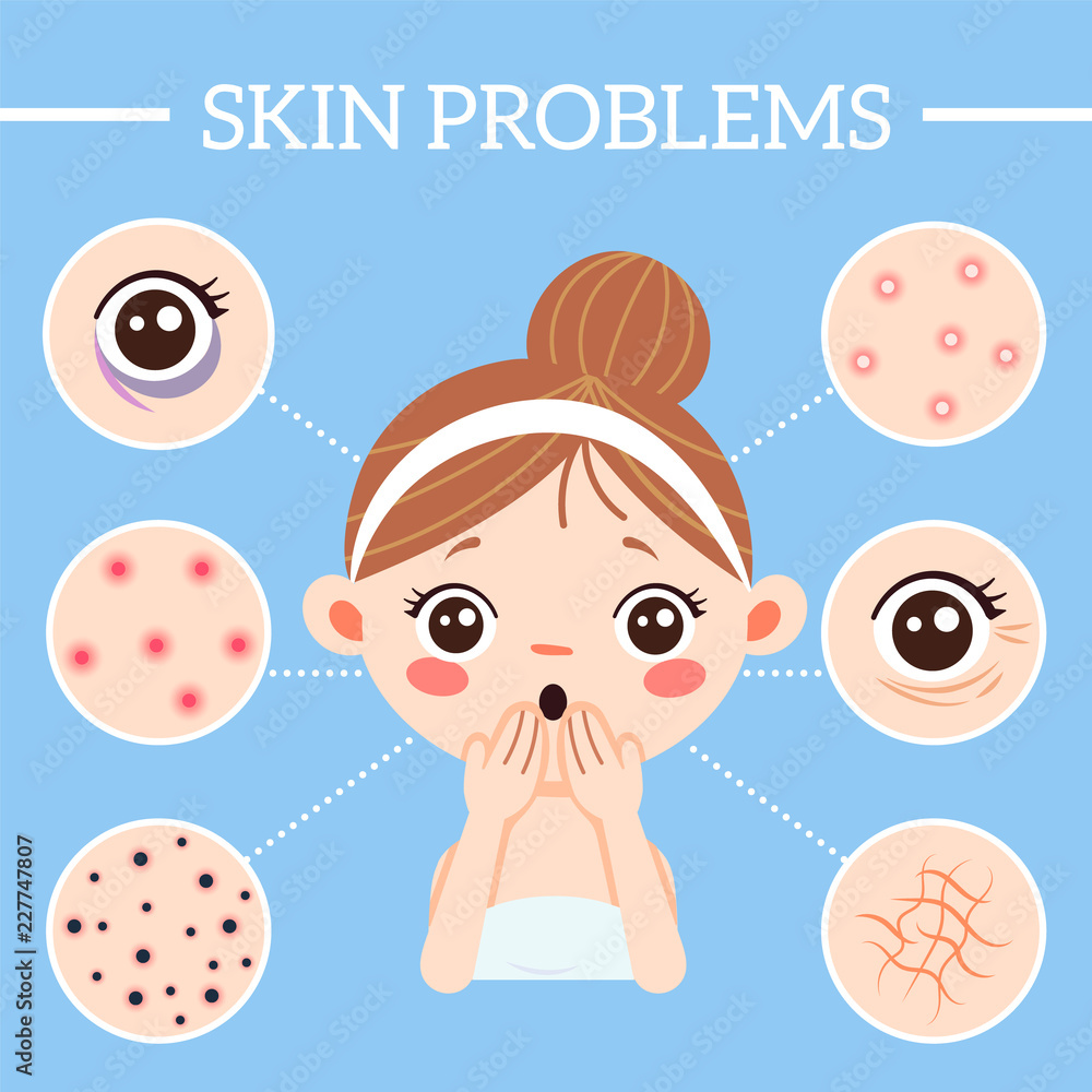Skin problems infographic. Ages wrinkles problems, blackheads and ...