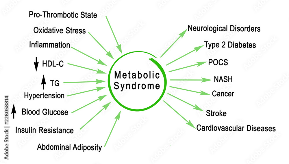 Poster Metabolic Syndrome – Wall Art | UkPosters
