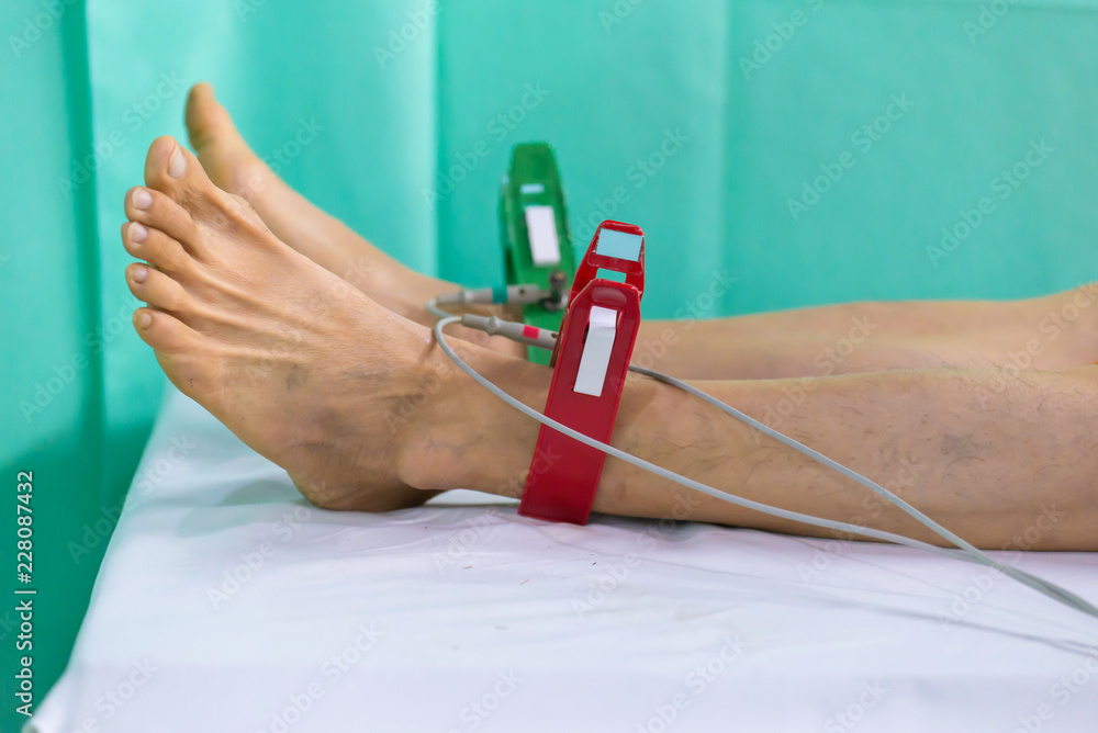 ECG Legs of man with electrodes for electrocardiogram records on bed in ...