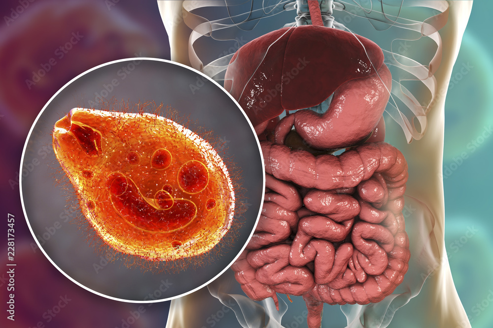 Balantidium coli protozoan in large intestine, 3D illustration ...