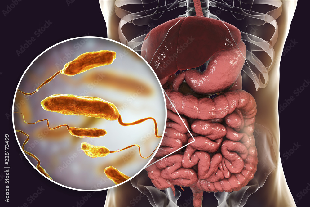 Vibrio cholerae bacteria in small intestine, 3D illustration. Bacterium ...