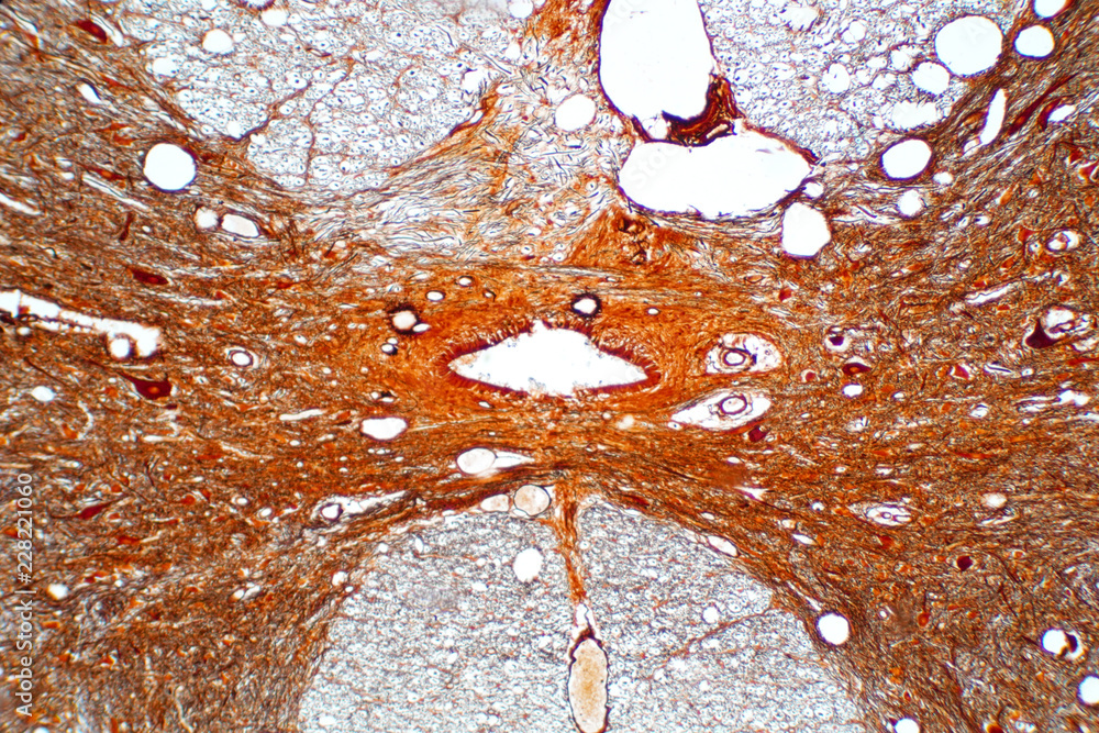 Cross section of spinal cord under the microscope view. Stock Photo ...