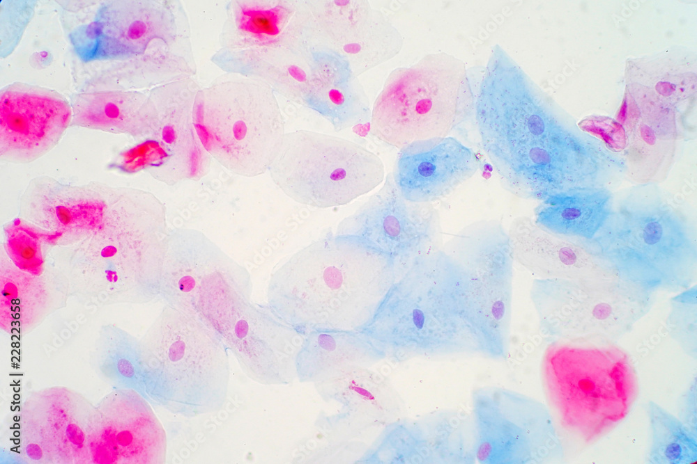 Epithelial Cells Under Microscope