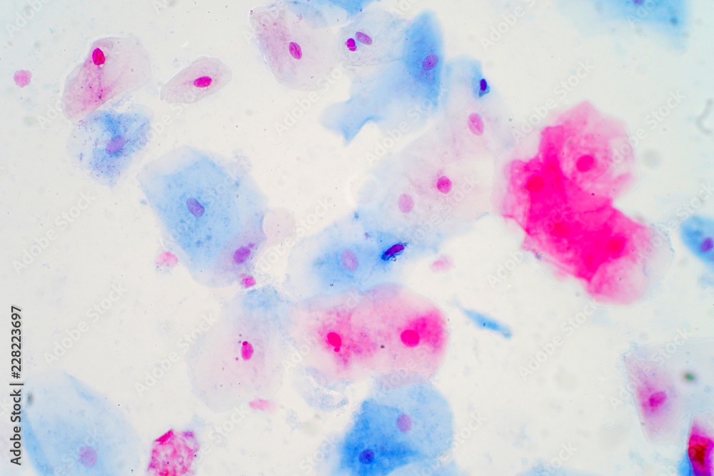 Squamous epithelial cells under microscope view for education histology ...