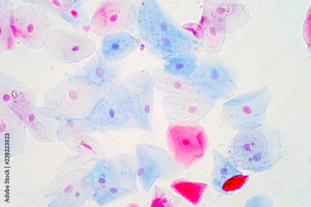 Squamous epithelial cells under microscope view for education histology ...
