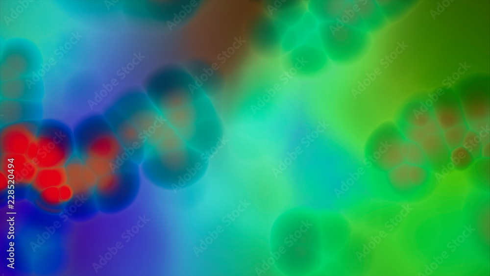 Cross section of the tissue in the microscopic view, cancer of a human ...