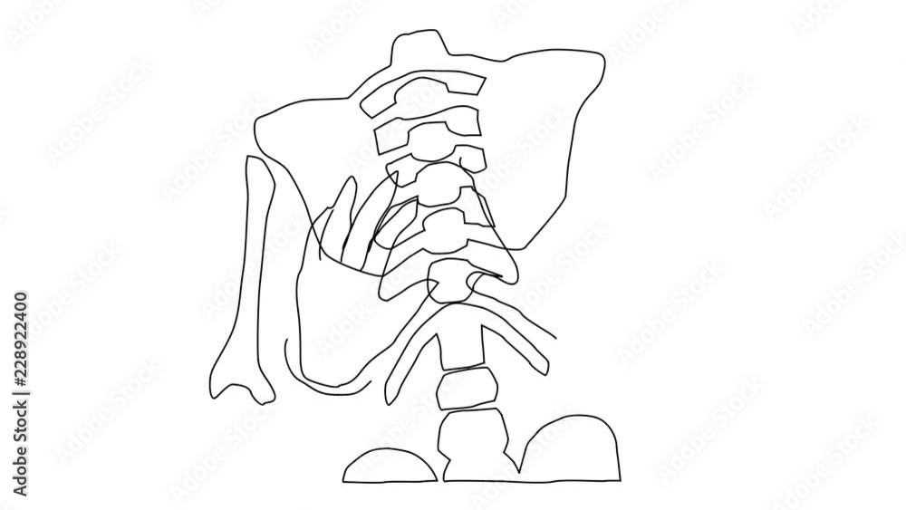Animated sketch vector drawing doodle of chiropractor hands on skeletal ...