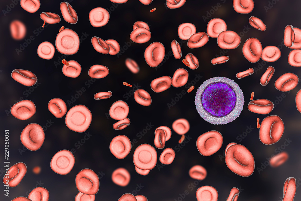 Iron deficiency anemia, 3D illustration showing small hypochromic red ...