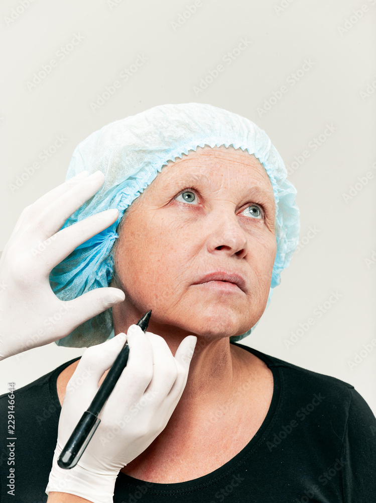 The surgeon doing skin check on mid age woman before plastic surgery ...
