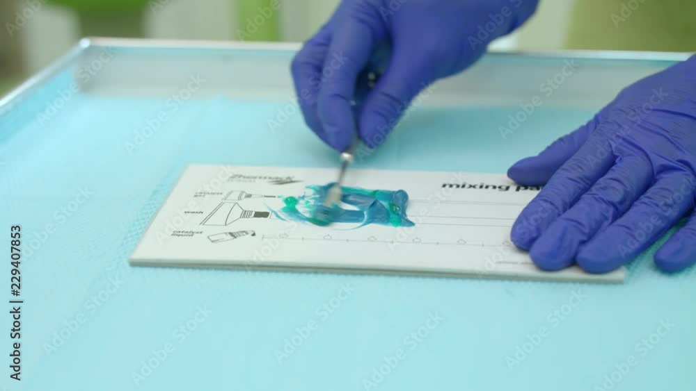 Video „Stomatologist creating component of dental imprint. Close up ...