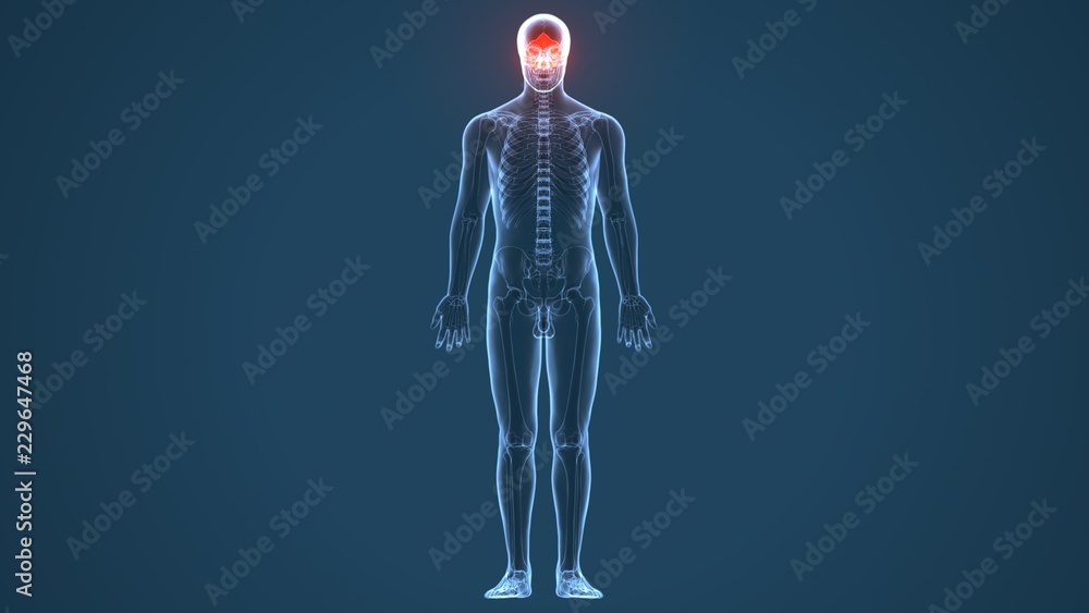 3d illustration Sinusitis . Film x-ray of human skull with inflamed at ...