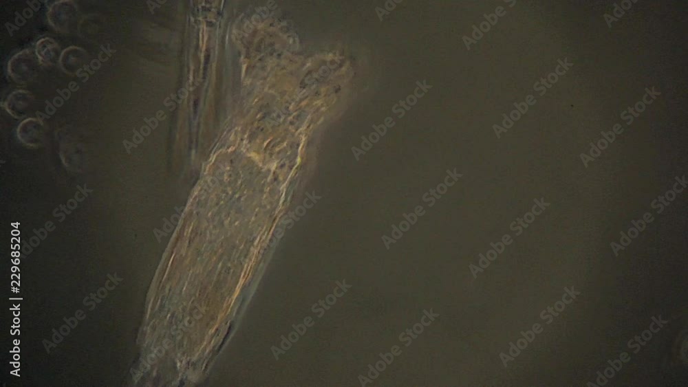 Microscopic Rotifera use cilia to filter feed, as seen through a phase ...